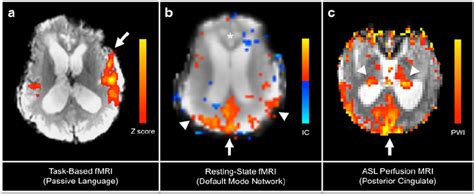 task based functional mri fmri resting state fmri and arterial download scientific