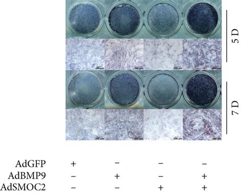 The Effect Of Smoc On Bmp Induced Early Osteogenic Marker Levels A