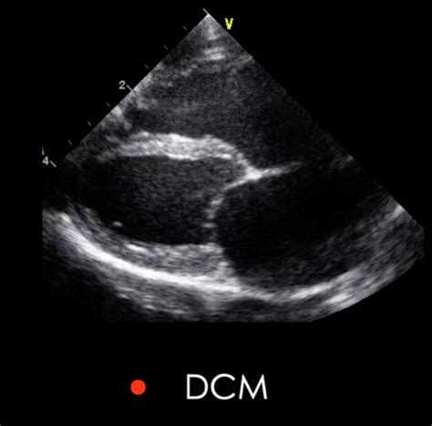 Echocardiography Flashcards Quizlet