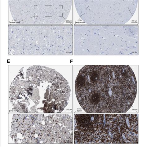 Hub Gene Analysis A MRNA Expression Level Of Hub Genes B