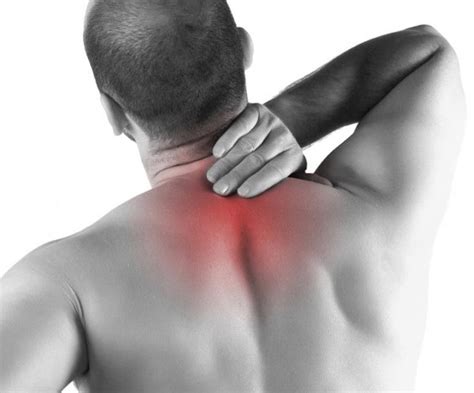 CERVICALGIA síntomas diagnóstico y tratamiento convencional JIM