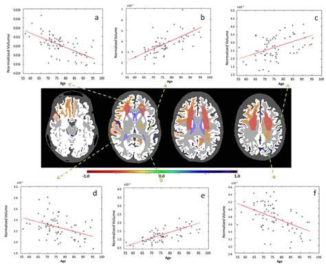 Examples Of Significant Correlations Between Regional Volumes And Age