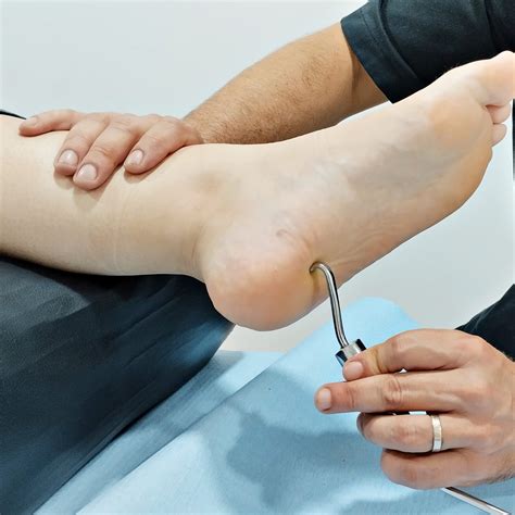 Fisioterapia Cranium Espolón Calcáneo qué Es Y Qué Síntomas Presenta