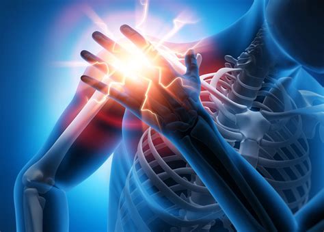 Biceps Tendon Tear At The Shoulder Sydney Shoulder And Elbow