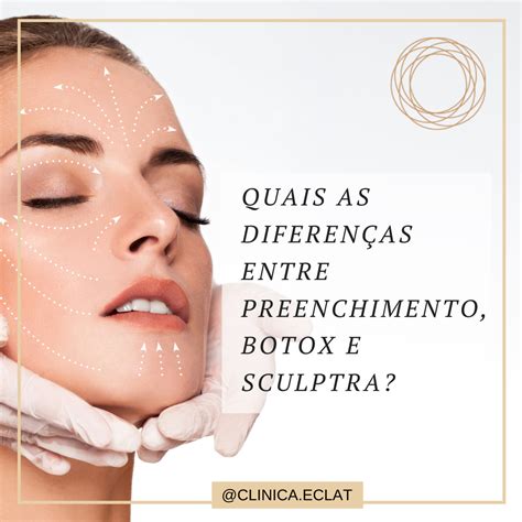 Quais as diferenças entre Botox Preenchimento e o Sculptra Clínica