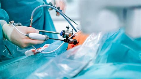 Entenda O Que E Como Feita Cirurgia Bari Trica Procedimento