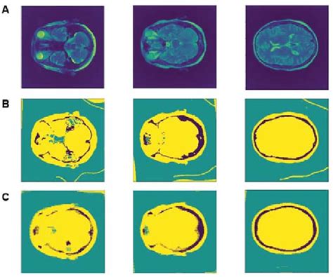 the segmentation results of t2 w mr images using transfer learning download scientific diagram