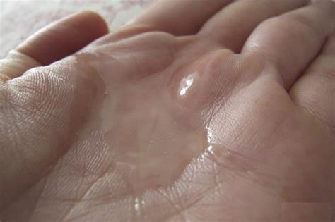 Tinh Dịch Màu Trắng Trong Là Bệnh Gì Dấu Hiệu Và Cách Chữa