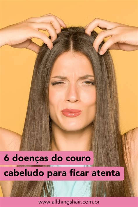 Conheça as doenças do couro cabeludo mais comuns e saiba como tratá las