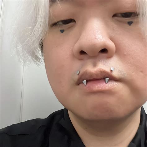 Downsized My Angel Fangs Today Rpiercing