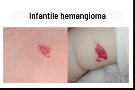 Red Spots On Skin 38 Causes Pictures And Treatment