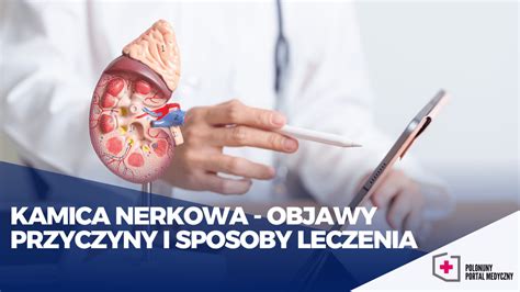 Kamica Nerkowa Objawy Przyczyny I Sposoby Leczenia Polonijny