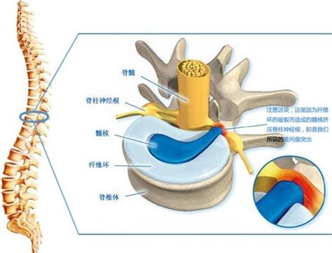 这些腰椎病治疗常识一定要知道！