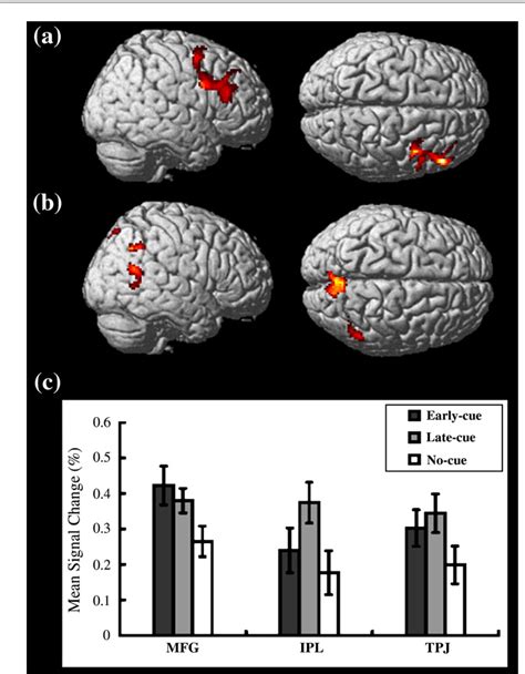 figure 1 from the neural correlates of attention orienting in visuospatial working memory for