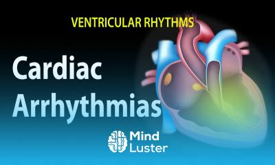 Learn Cardiac Arrhythmias Animation Mind Luster