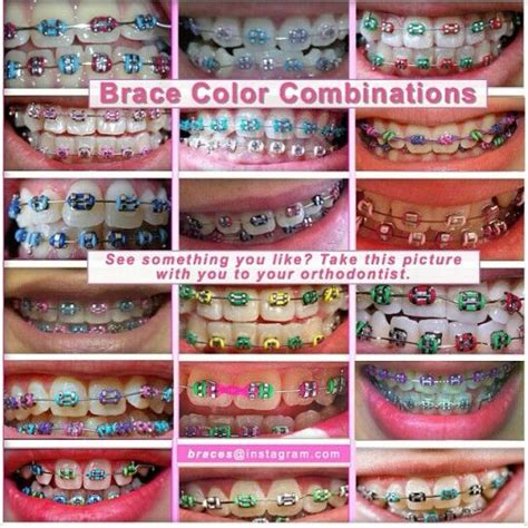 Color Combinations Cute Braces Colors Braces Colors Combinations