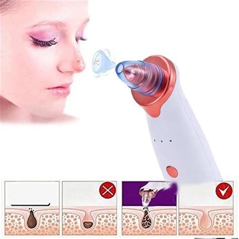 Aliexpress Buy Electric Facial Vacuum Pore Cleaner Acne Blackhead