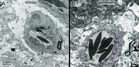 Electron Micrographs Showing Ultrastructural Differences In Capillary