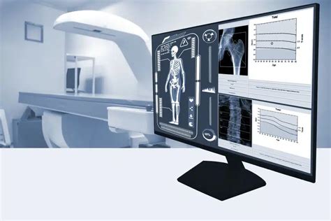 Densitometría Ósea en Lima Perú Biomedic