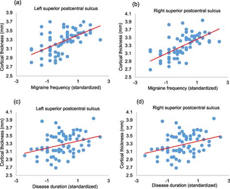 Full Article Cortical Sulcal Abnormalities Revealed By Sulcal