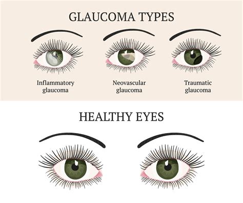 Glaucoma Screening Test Gst From Haag Streit