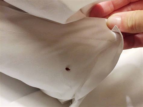 All About Bed Bugs Are They Visible To The Naked Eye