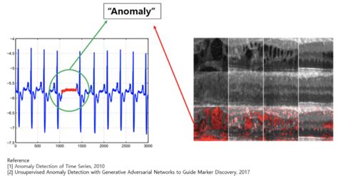introduction to anomaly detection · 인생을 여행처럼🛫