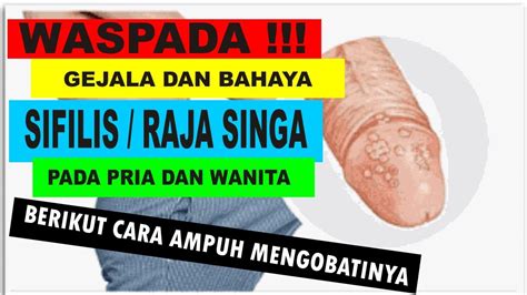 Gejala Penyebab Dan Pengobatan Infeksi Menular Seksual Sifilis Raja