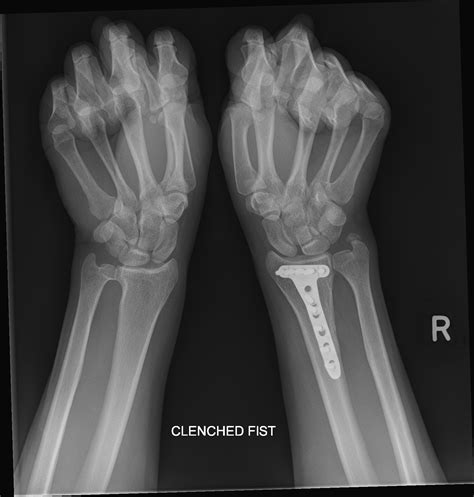 Image Radiopaedia Org