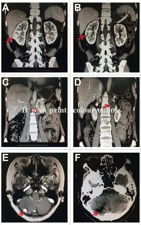 Computed Tomography CT And Magnetic Resonance Imaging MRI Scans