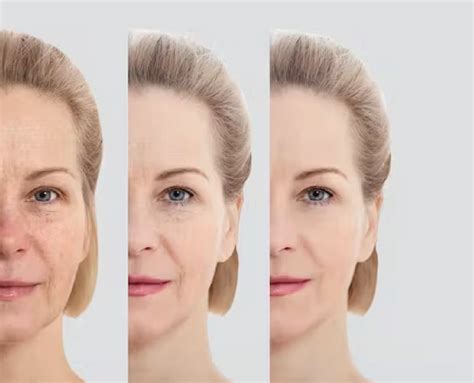 Ozempic Face Tips To Help Facial Volume Loss And Re Build Collagen