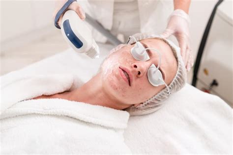 Laser Treatments For Acne What You Should Know Ohio Laser Wellness