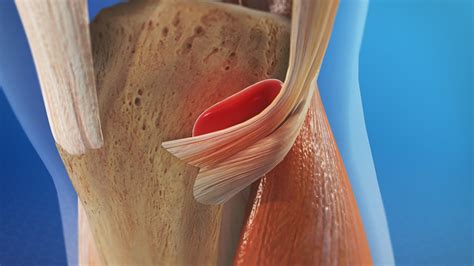 Pes Anserine Bursitis Dnbinger The Best Porn Website