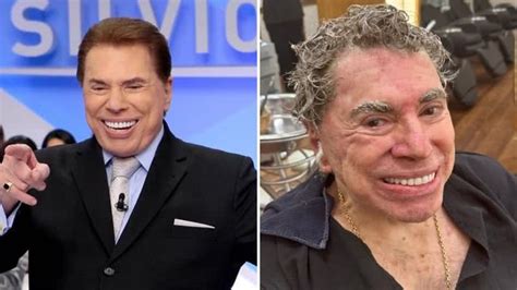 Quantas Pl Sticas Silvio Santos Tinha Apresentador N O Fez Ltima Por