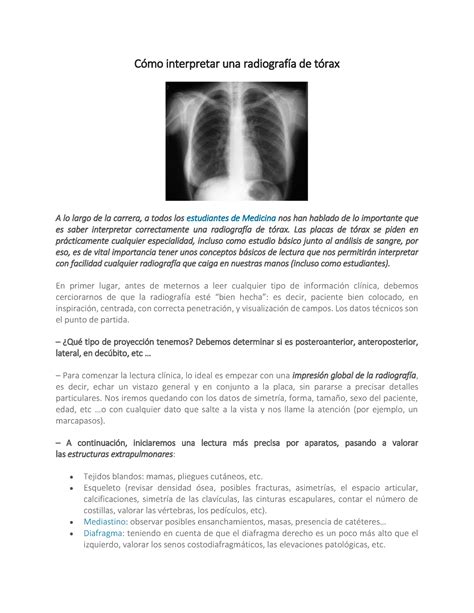 Cómo interpretar una radiografía de tórax ejercicio CÛmo interpretar