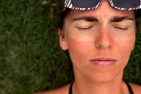 Consejos Para Una Piel Hidratada Y Bella Durante El Verano