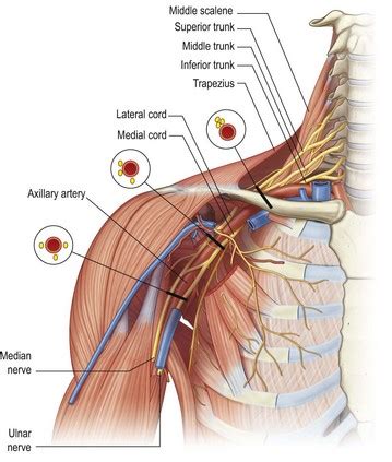 Limb Blocks Anesthesia Key