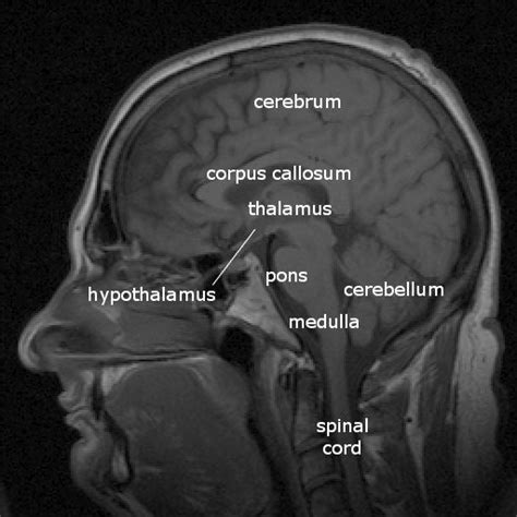 Brain MRI Medical Radiography Radiology Mri Brain
