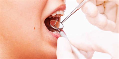 Técnicas de prevención de las enfermedades periodontales Estudi