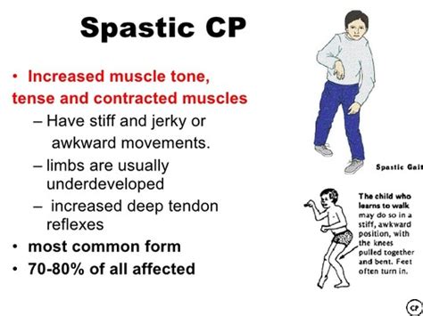 PEDs Neuromuscular Dysfunction Flashcards Quizlet