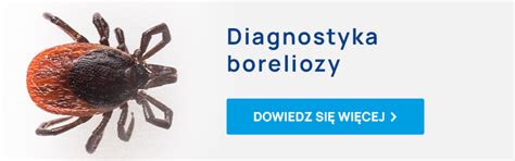 Borelioza I Choroby Odkleszczowe Centrum Wiedzy ALAB Laboratoria