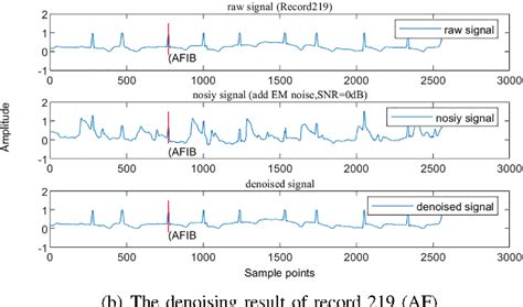 figure 14 from an ecg signal denoising method using conditional generative adversarial net