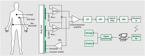 schematic representation of the ecg system architecture and electrode download scientific
