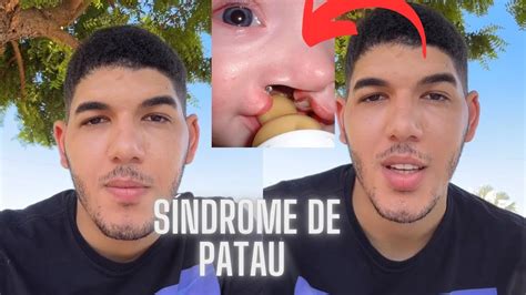 Zé Vaqueiro se pronuncia a primeira vez após filho nascer Síndrome