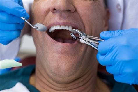 Lextraction des dents de sagesse améliore les capacités gustatives étude