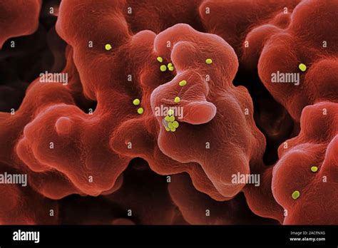 MRSA Bacteria Coloured Scanning Electron Micrograph SEM Methicillin