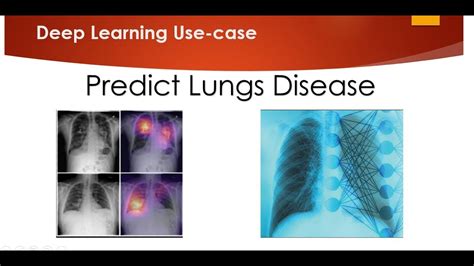predicting lungs disease using deep learning youtube
