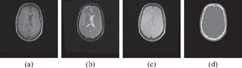 figure 1 from a continuous method for reducing interpolation artifacts in mutual information