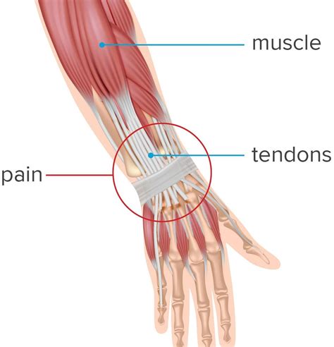 Wrist Tendon Anatomy