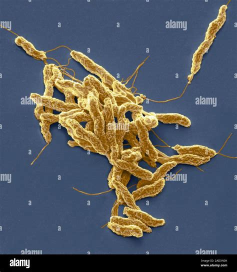 Campylobacter Jejuni Bakterien Farbige Scanning Electron Micrograph